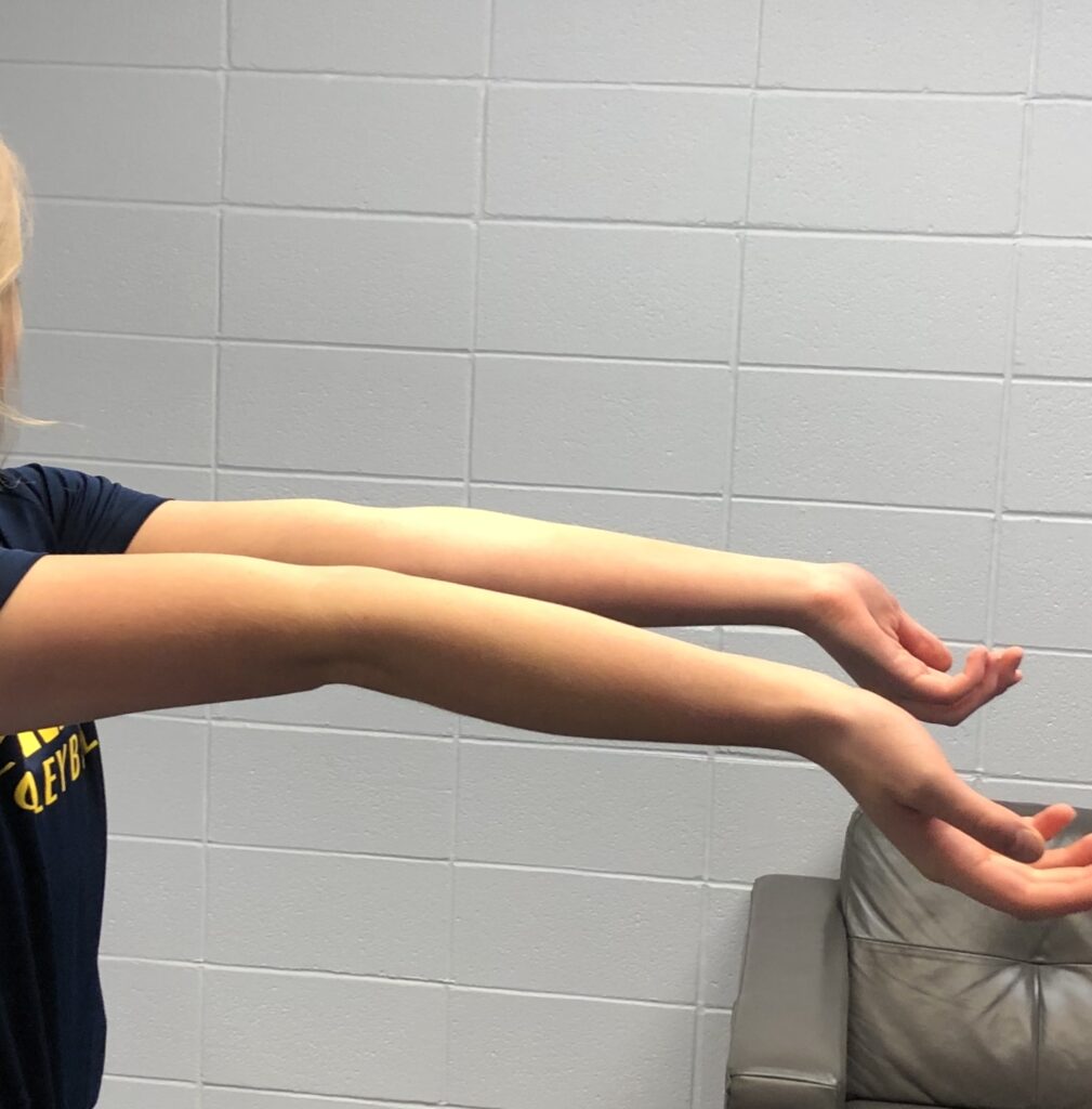 Why Proper Overhead Lifting Really Matters for Volleyball Players